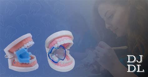 What Are Bite Blocks For Braces Blog Dental Braces