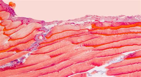 От какви тъкани са изградени мускулите ни Дигитален урок Bg Електронно обучение и учене Mozaik