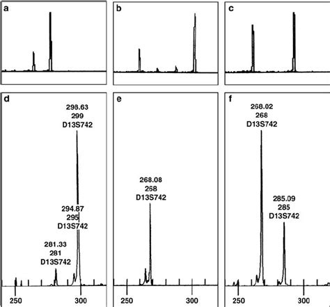 Example Flt3 Itd Excess And Str Allele Dosage Results For Patients 1 2 Download Scientific