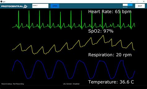 healthypi 5 wifi and ble biosignal acquisition sensor platform captures