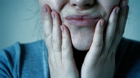 Крупный план проблем с кожей нездоровая кожа с акне и прыщами пористый демодекоз и розацеа