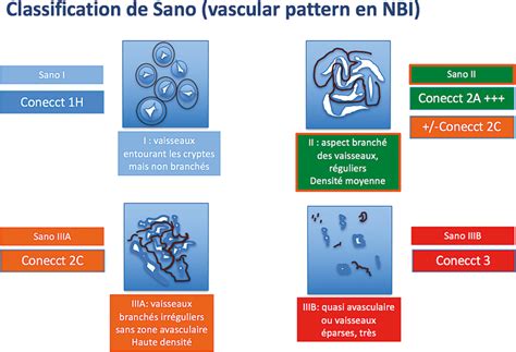 Classifications Des Polypes Coliques Comment Sy Retrouver Fmc Hge