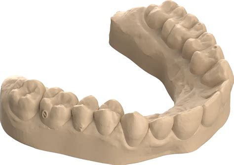 Dental 3d Printing