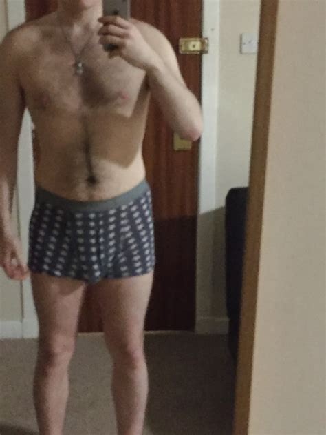 Maletorsodetection Object Detection Model By Abdullah Ws 2025