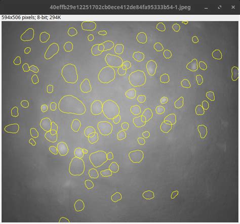 Stardist 2d Doesnt Detectsegment Round Objects In My Image Image Analysis Imagesc Forum