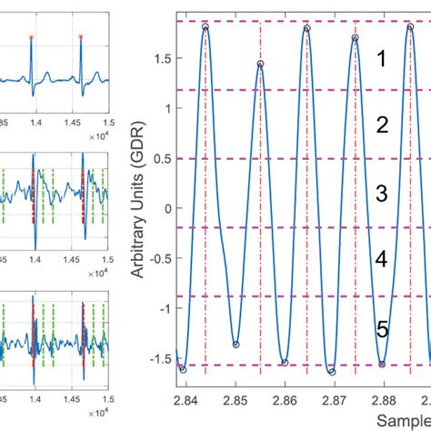 Cardiac And Respiratory Cycle Segmentation A 3 Bin Segmentation Was Download Scientific