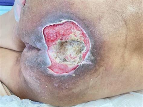 Test Object Detection Dataset By Test