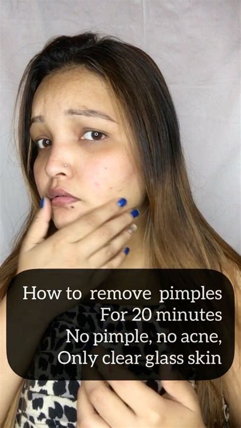 How To Remove Pimples For 20 Minutes No Pimple No Acne Only Clear Glass Skin Facetaning