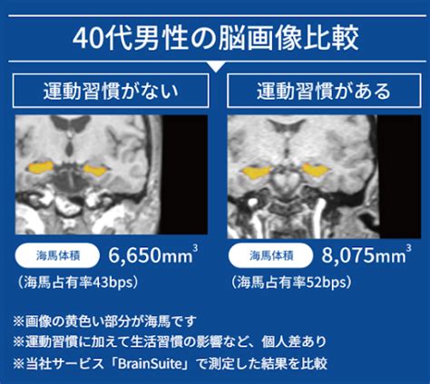 海馬とは記憶をつかさどる脳の海馬について徹底解説 公式BrainSuite ﾌﾞﾚｲﾝｽｲｰﾄ