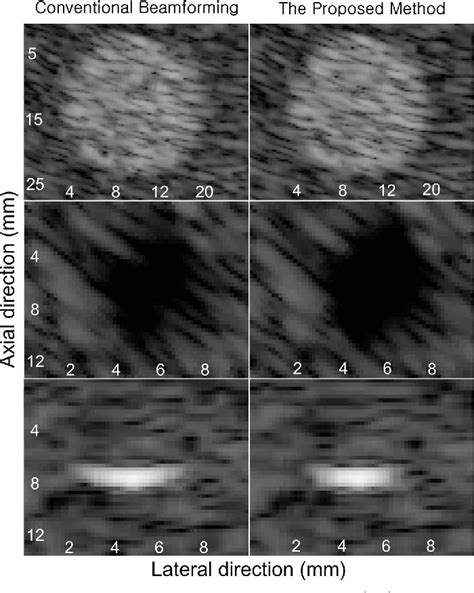 Figure 4 From Optimal Sound Speed Estimation Using Modified Nonlinear
