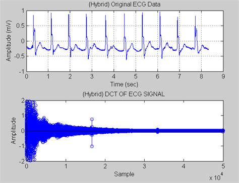 Original Ecg Signal And Dct Of Ecg Signal Of Mit Bih Record 102 Download Scientific Diagram