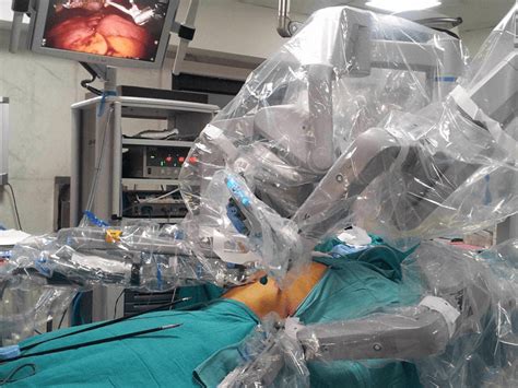 Laparoscopic Robotic Appendectomy A Patients Guide