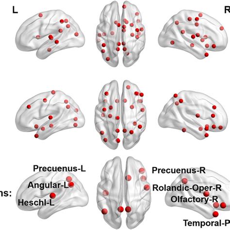 The Parameters In Logistic Regression Were Defined Using Elastic Net