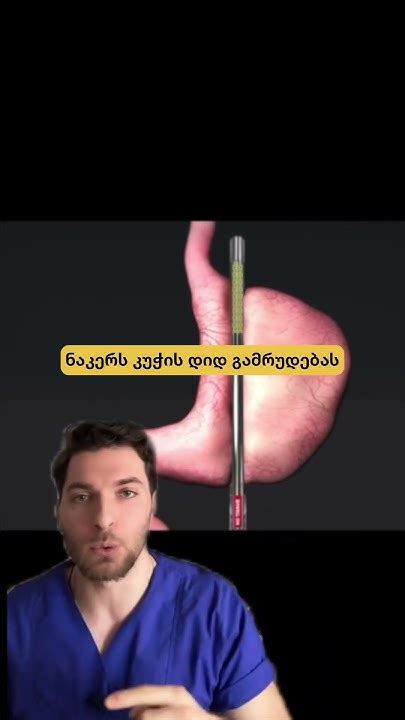 ბარიატრიული ოპერაცია მედიცინა სამედიცინო ექიმი Youtube