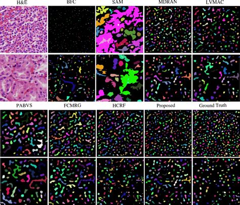 Segmentation Result Illustration By Two Samples Of Hande Stained Download Scientific Diagram