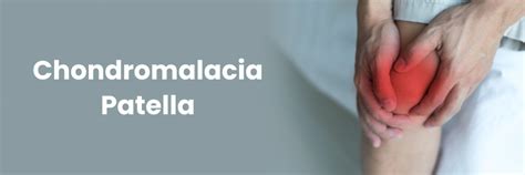Chondromalacia Patella Symptoms Causes And Treatment