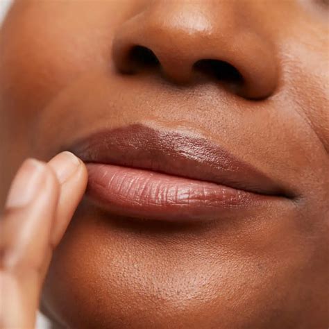 Hylenex Filler Dissolver Treatment Ject