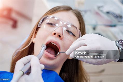 치과 의사의 구강 검진 중 입을 벌수있는 여성의 클로즈업 건강관리와 의술에 대한 스톡 사진 및 기타 이미지 건강관리와 의술 약 치과 의사 Istock