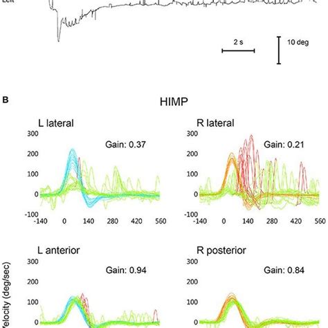 Horizontal Videonystagmography Vng Recording Of The Left Eye Showing Download Scientific