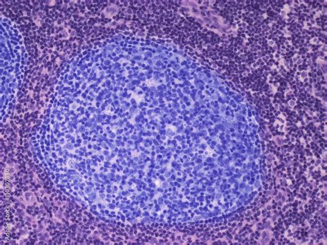 Lymph Node Light Micrograph Stock Photo Adobe Stock