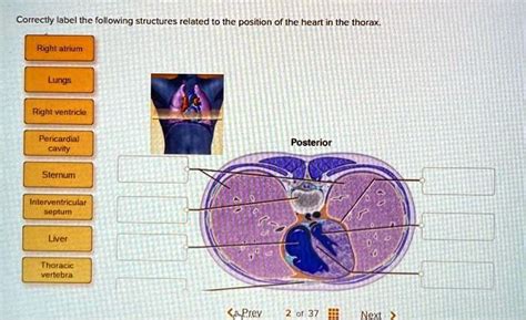 Texts Correctly Label The Following Structures Related To The Position Of The Heart In The