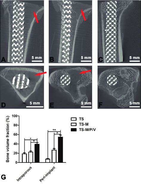 Quantitative Micro CT Ex Vivo Imaging And BVF Of The TS TS M And Download Scientific Diagram