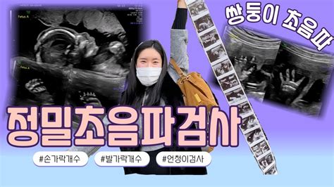 임신20주 정밀초음파검사 하고 왔어요 성별 반전은 없었다 정밀초음파 분석하기 손가락 발가락 너무 귀여워요 임산부 브이로그 쌍둥이 초음파 영상