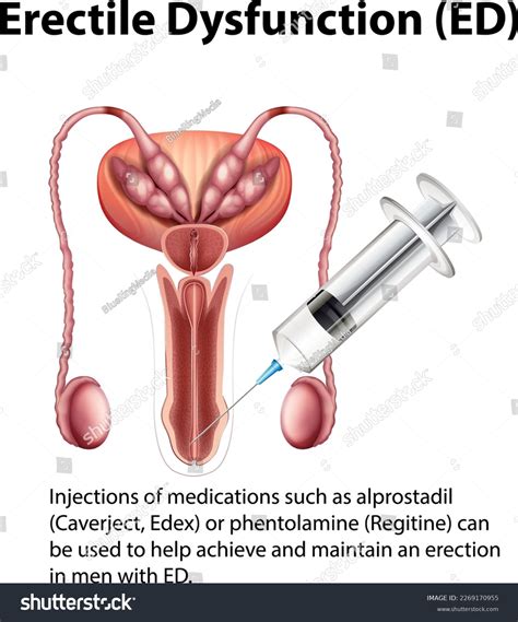 3 Ed Internal Organs Images Stock Photos Vectors Shutterstock