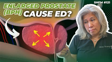 Can Prostate Enlargement Cause Erectile Dysfunction Sale Online