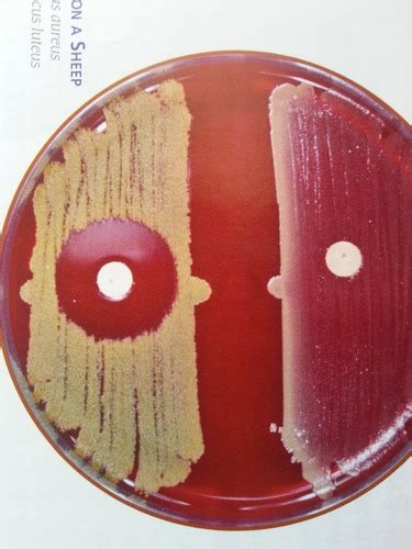 Bacitracin Sensitivity Test Flashcards Quizlet