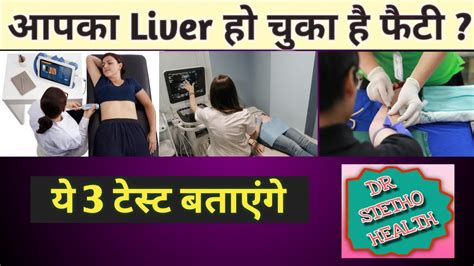 Tests for Fatty Liver Blood Test for Fatty Liver फट लवर क लए य 3 टसट जरर कर ल