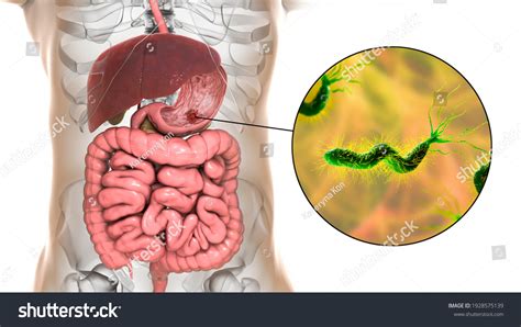 2194 Helicobacter Pylori 이미지 스톡 사진 및 벡터 Shutterstock