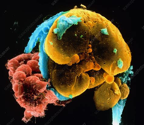 coloured sem of a 6 8 cell segmenting human embryo stock image p680 0369 science photo library