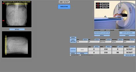 Learn Ct Protocol Multi Phase Liver