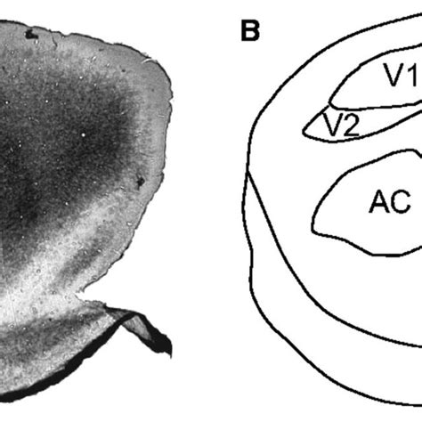 Anatomical Organization Of The Vole Cortex A A Tangential Section Of Download Scientific