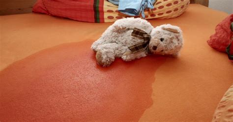 التبول الليلي اللاإرادي في الأطفال