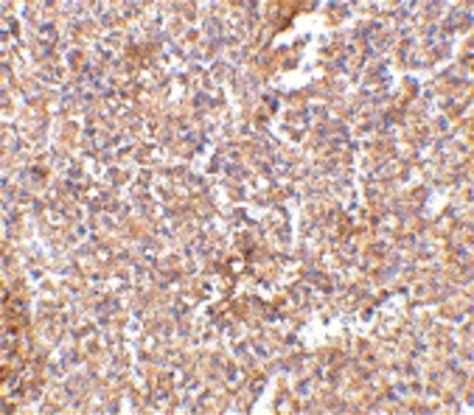 Steap1 Antibody Cat No 4305 Prosci