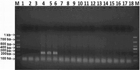Rpa Primer For Detecting Duck Derived Component Kit And Detection Method Eureka Patsnap