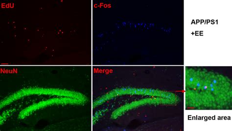 C‐fos Expression In Newborn Neurons In The Dg Area Of The Appps1 Mice Download Scientific