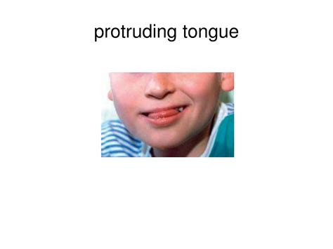 Ppt Understanding Lip And Oral Anomalies A Comprehensive Guide
