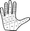 Diagram Showing How The Semmes Weinstein Monofilament Sensibility Test