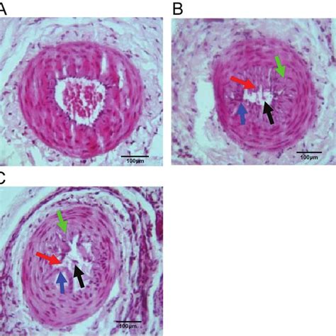 Transmission Electron Microscopy Of The Rat Femoral Artery