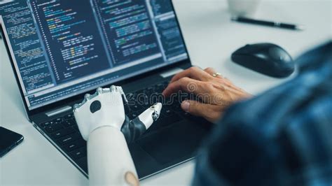 Over Shoulder Hands Close Up Programmer With Disability Using Prosthetic Arm To Work On Laptop
