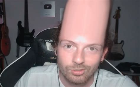 O Andre Falou Que Tem A Testa Grande Mas Até Que é Pequena R Andreyoung