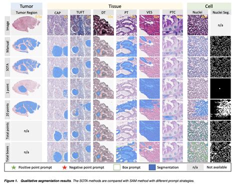 Segment Anything Model Sam For Digital Pathology Assess Zero Shot
