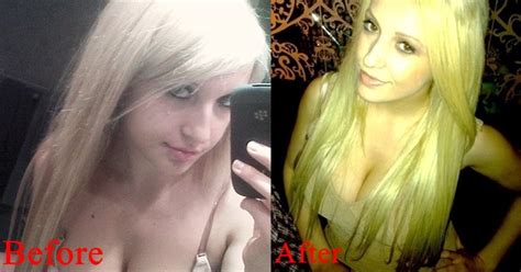 Real Life Ken And Barbie Dolls Plastic Surgery Before And After