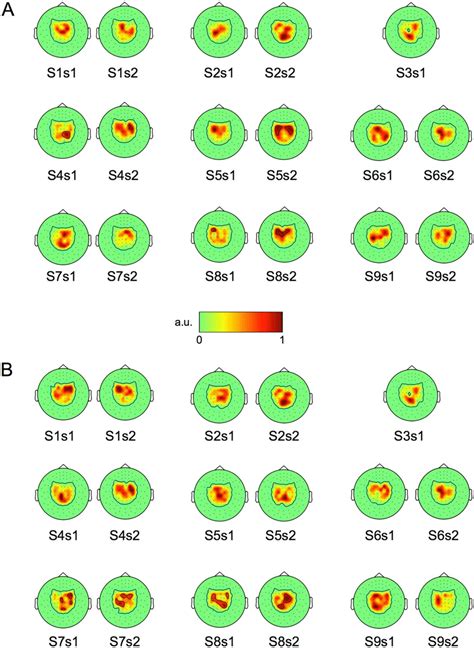 Spatial Patterns Of The Csp Components Showing The Highest 1020 Hz Download Scientific Diagram
