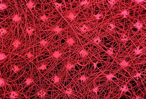 Tinted Sem Of Polypropene Filaments Photograph By R E Litchfield Science Photo Library Fine