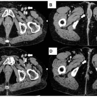 A Histological Findings Of Vulvar Excision Specimens At Initial Download Scientific Diagram