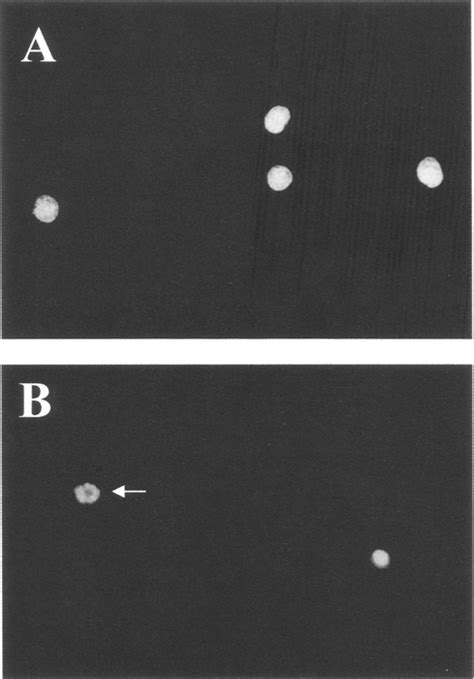 Fluorescence Microscopy Performed After Staining With Dapi Of Untreated Download Scientific